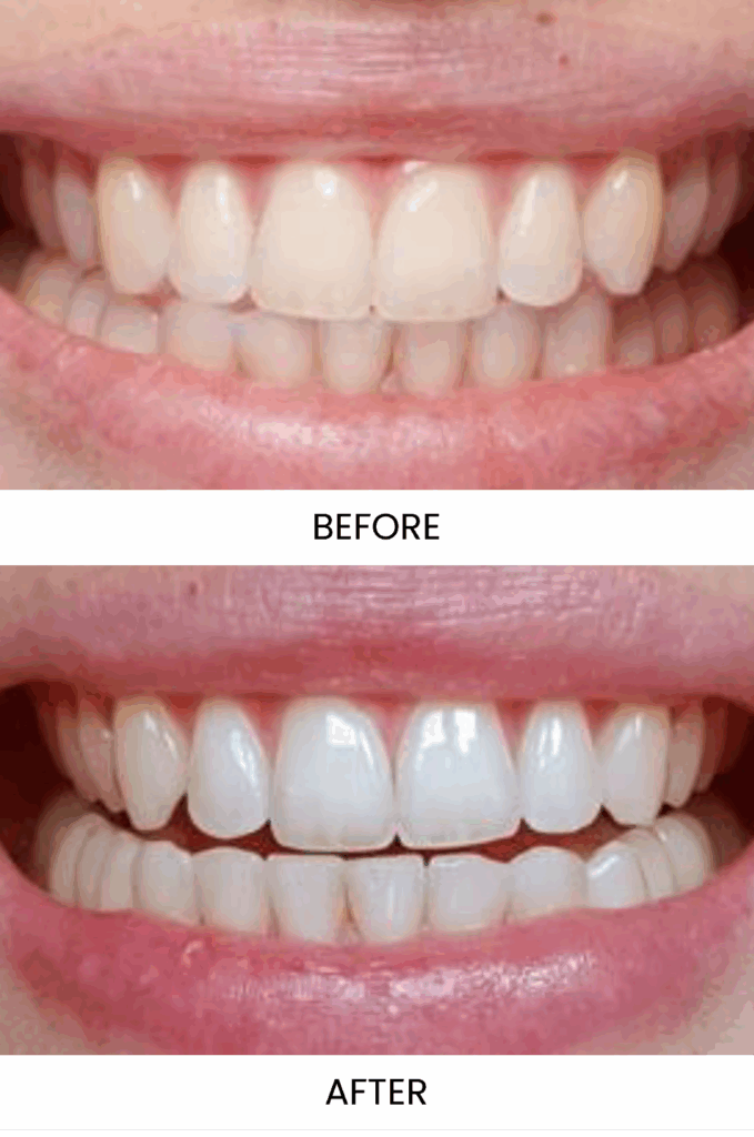 Enamel Serum - vVARDIS Switzerland - Biomimetic Dental Science