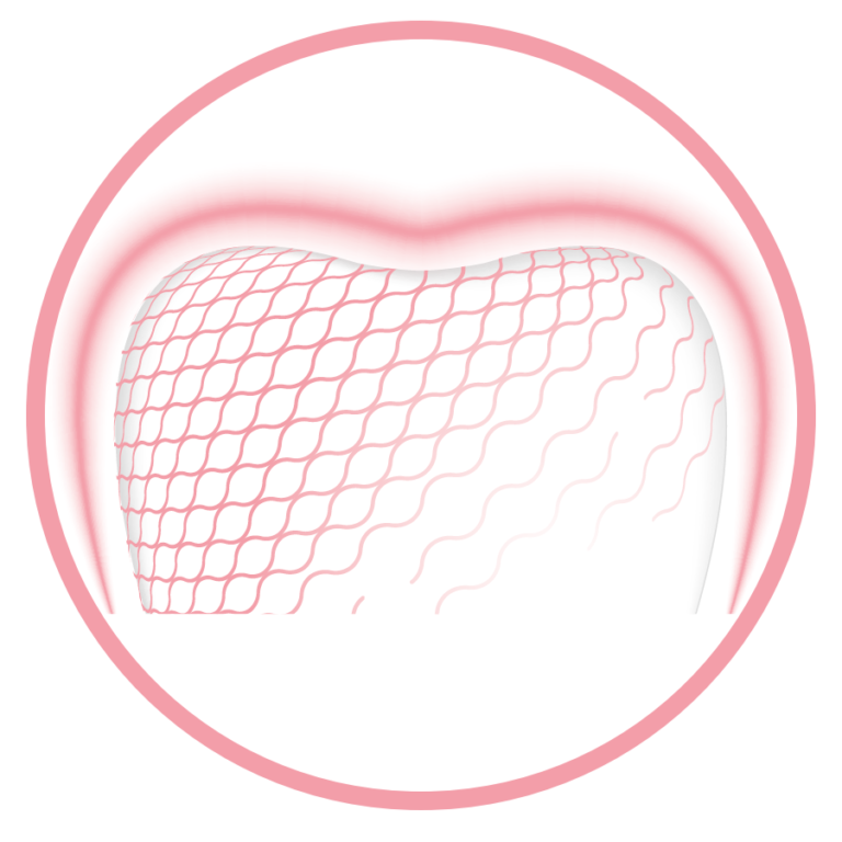 CurodontTM Protect - vVARDIS Switzerland - Biomimetic Dental Science