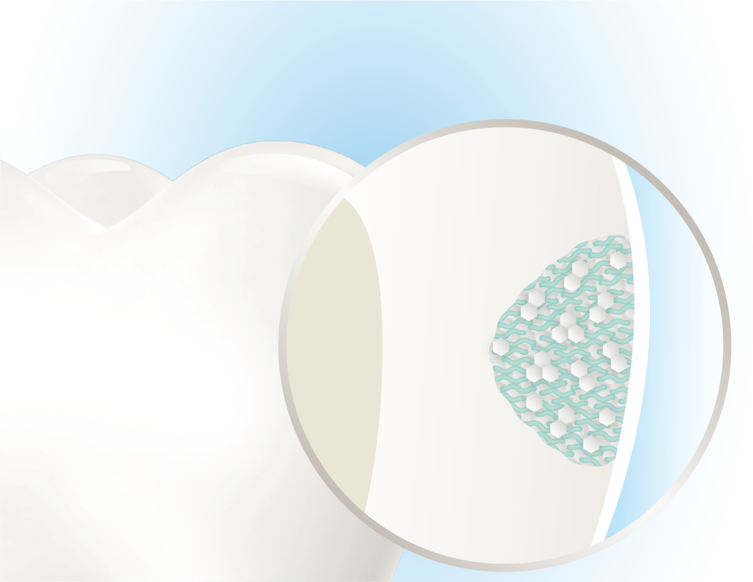 CurodontTM Repair - vVARDIS Switzerland - Biomimetic Dental Science